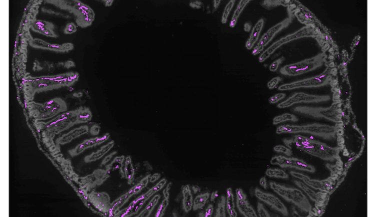 Liberles Lab deconstructs gut-to-brain signals of the vagus nerve ...