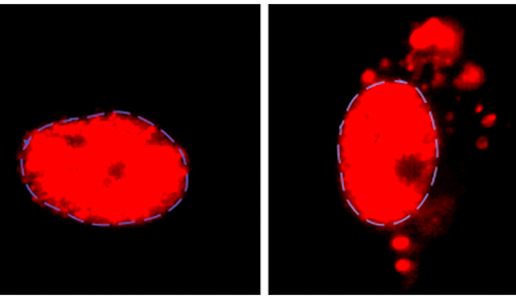 New study by Reed lab reveals how RNA splicing errors may cause the ...