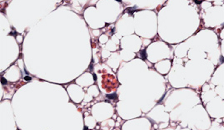 Spiegelman Lab discovers that some fat cells can directly sense cold ...